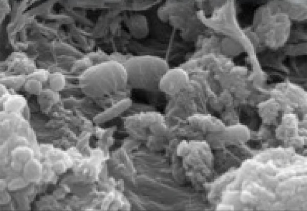 Successful winter nutrition starts with feeding the microbes - New ...